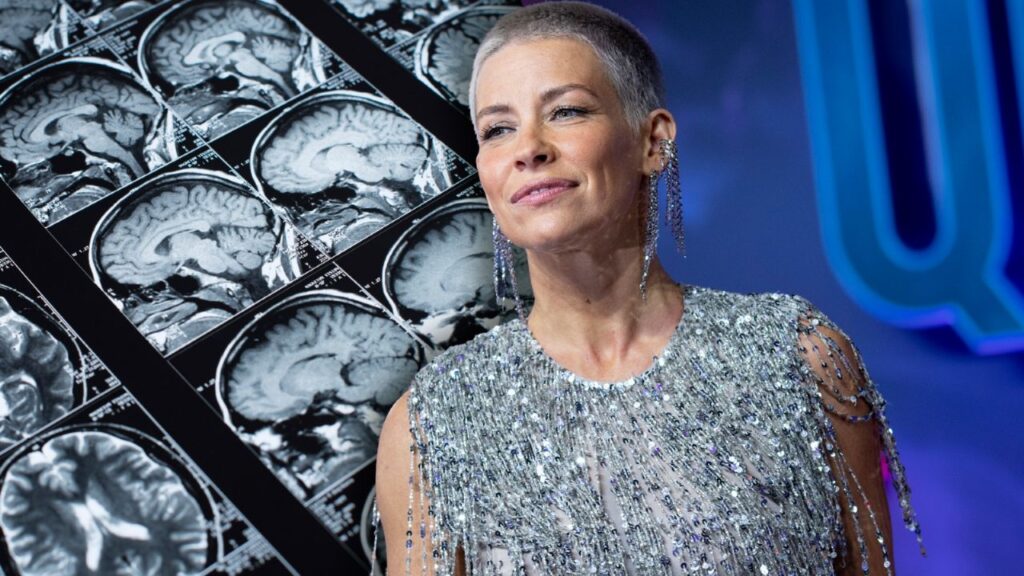 Evangeline Lilly: Causas del daño cerebral de la estrella de Ant-Man